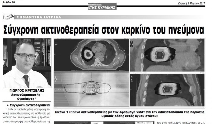 Oncocare - Γ. Κριτσέλης | Συχρονη Ακτινοθεραπεια στον Καρκινο του Πνευμονα