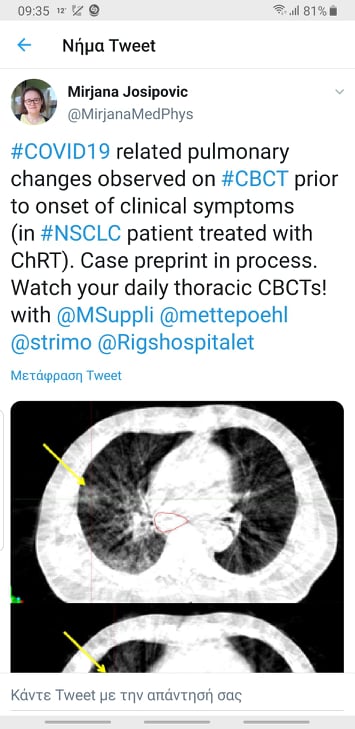 Oncocare - Γ. Κριτσέλης | Πρωιμη ανιχνευση του covid-19 σε ασθενεις με ...